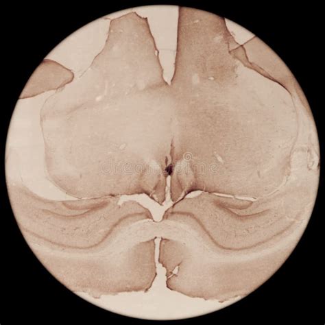 Micrograph Of Rat Brain Stock Image Image Of Material 37007793