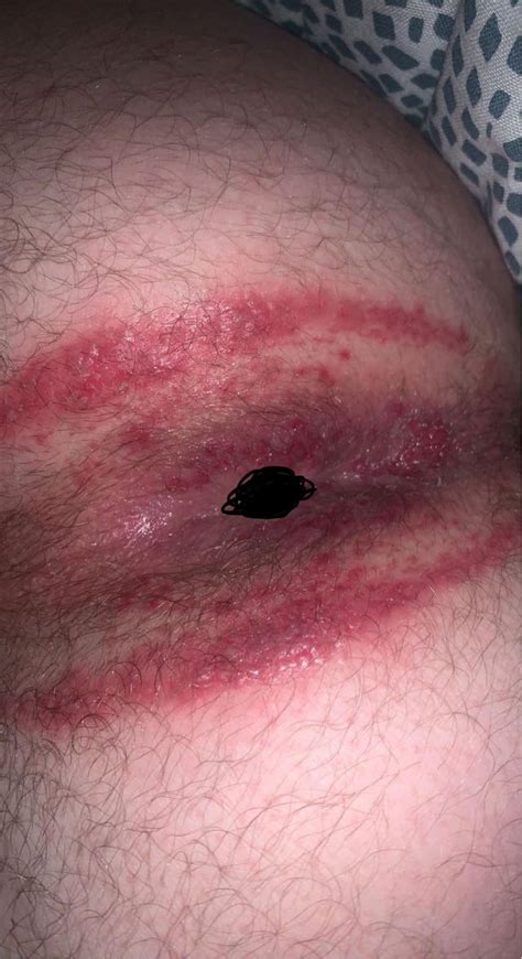 What Does Drd Mean On R Std