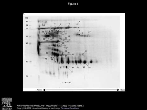 Proteomic Analysis Of Normal Human Urinary Proteins Isolated By Acetone