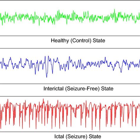 Sample Eeg Signals For A Healthy Control B Interictal Download Scientific Diagram