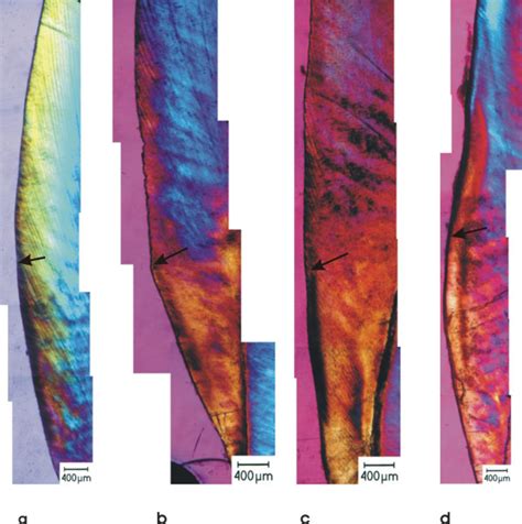 Polarization Light Microscopy Of Experimental Lesions Experimental