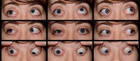 A Tale Of Med Students Oculomotor Nerve Cranial Nerve III 3