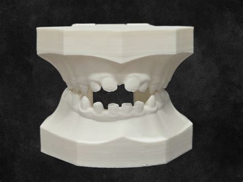 Pediatric Dental Typodont—open And Cross Bites By Drshelby Makerworld