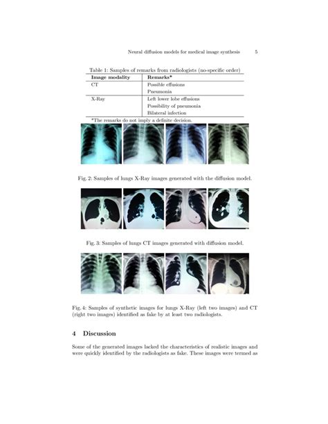 Spot The Fake Lungs Generating Synthetic Medical Images Using Neural