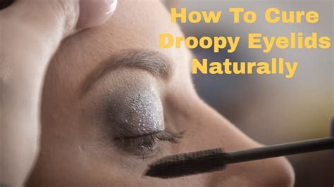How To Treat Droopy Eyelids Naturally Youtube