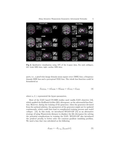 deep attentive wasserstein generative adversarial networks for mri