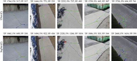 Best Vs Worst Qualitative Predictions Best Unet Jaccard Loss Download Scientific Diagram