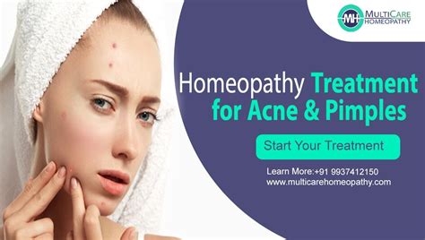 How Can I Cure My Pimples And Acne Permanently By Multicare Homeopathy