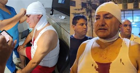 Ulises Villegas alcalde de Comas denuncia que sufrió atentado tras