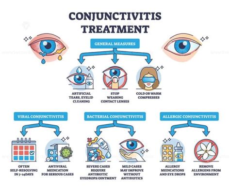 Conjunctivitis Treatment With Medicines And Medical Help Outline