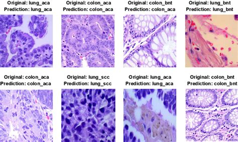 Figure 3 From A Multi Cancer Detection And Localization System Utilizing X Ai And Ensemble