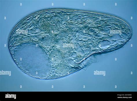 Blepharisma Protozoan Differential Interference Contrast Micrograph Of A Blepharisma Japonicum