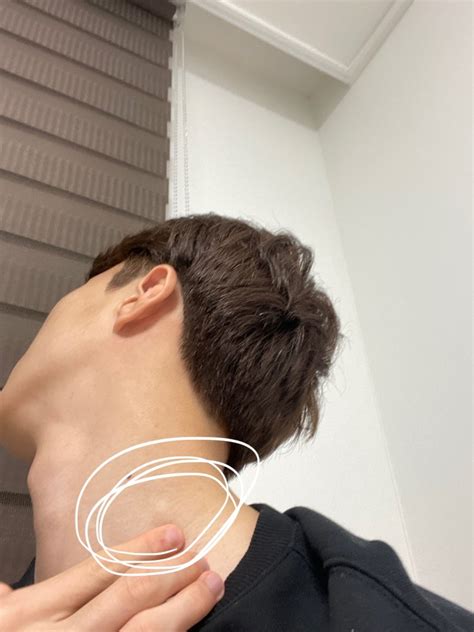 목에 혹같은게 생겼어요 지식in