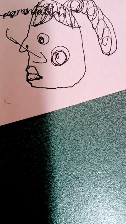 Hyperpegmentation Youtube