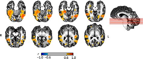 Frontiers Cosmomvpa Multi Modal Multivariate Pattern Analysis Of Neuroimaging Data In Matlab