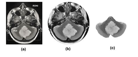 A Roi With Using Rectangle B Roi With Using Square C Proposed