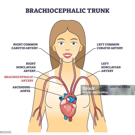 Ilustración De Anatomía Del Tronco Braquiocefálico Con Diagrama De