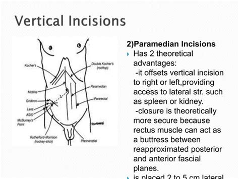 Surgical Incisions With Images Medical Mnemonics Medi