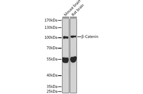 Anti Beta Catenin Antibody A80413