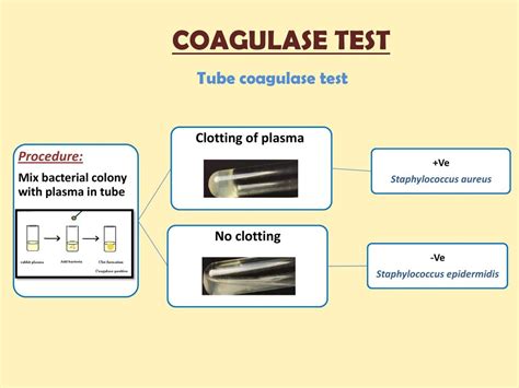 Urinary Tract Infection Department Of Microbiology Ppt Download