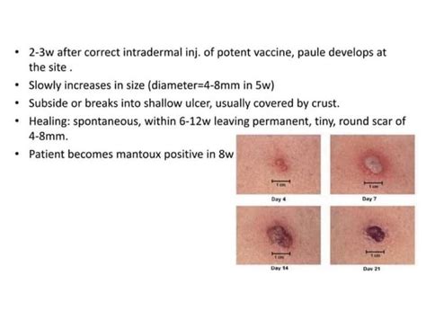 Immunisation Pptx Pptx Stjjrtiolbse Pptx