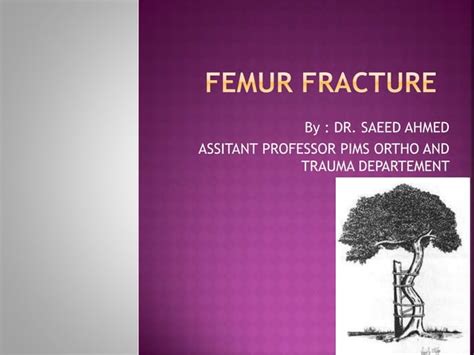 Femur Fracture And It Management And Cases Pdf Death Injury Or
