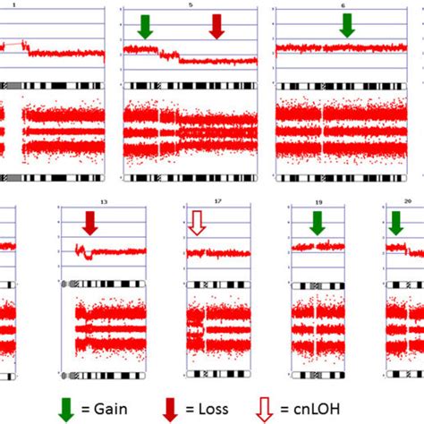Chromosomal Microarray Analysis Showing Multiple Genomic Imbalances In