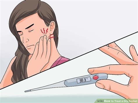 How To Treat A Dry Socket 15 Steps With Pictures Wikihow