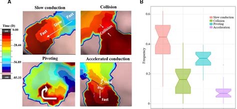 Diverse Activation Patterns During Persistent Atrial Fibrillation By