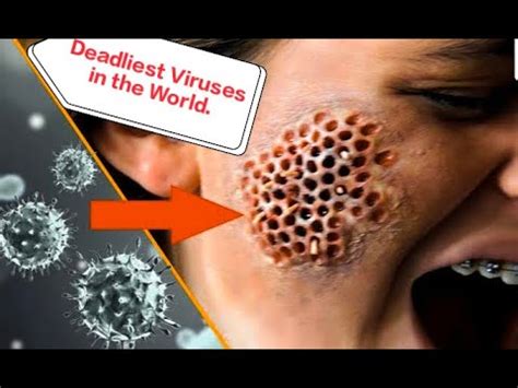 Most Dangerous Viruses In The World YouTube