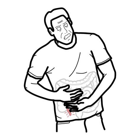 Acute Appendicitis Armando Hasudungan