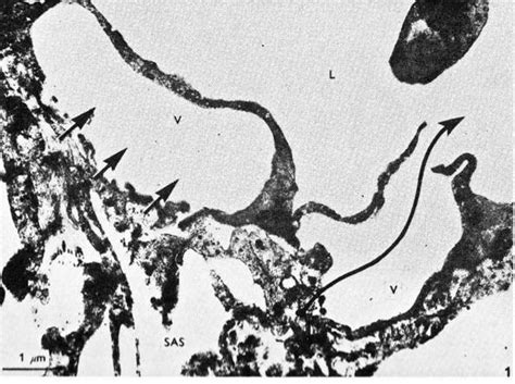 Electron Micrograph Of The Mesothelial Cells Lining The Arachnoid