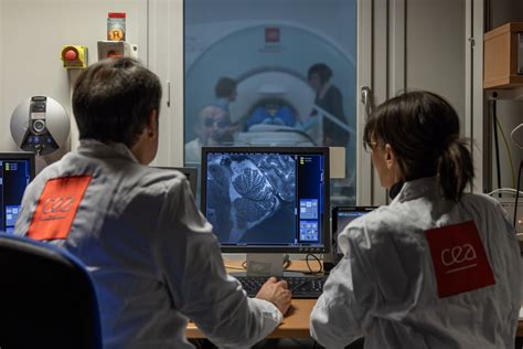 Nieuwe Superscanner Geeft Scherpste Mri Beelden Van Hersenen Ooit