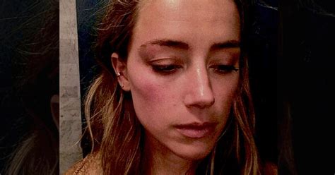 Johnny Depp Chuckles As Amber Heards Bruised Face Is Shown To Jury