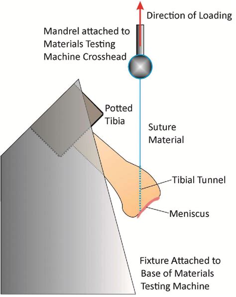 Figure 2 From The Strength Of Transosseous Medial Meniscal Root Repair