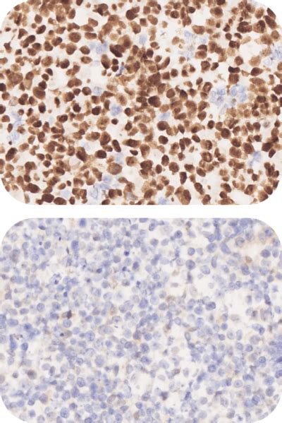 Standard Controls Archives Histocyte