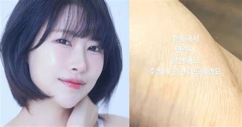 ‘당당한 성형 이세영 갑작스러운 근황 공지 “수술해서 연락 잘 안돼요”
