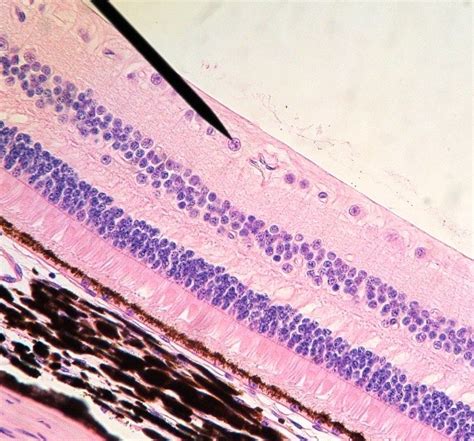 Retina Microscope Slide Diagram Quizlet