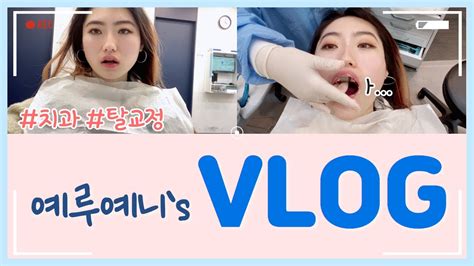 Vlog 드디어 교정기 탈출 탈교정 브이로그ㅋㅋㅋㅋㅋ Youtube