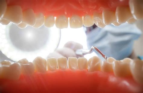 Problemas de los Implantes Dentales Clínica Dental González Baquero 2024
