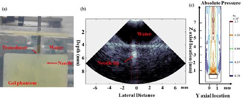 Figure 11 From A Miniature Forward Looking Phased Array Transducer For