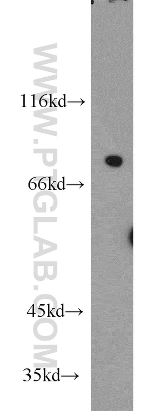 Nckipsd Rabbit Anti Human Mouse Polyclonal Proteintech 150 μl