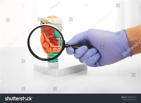 Enlarged Thyroid Gland Diffuse Toxic Goiter Stock Photo Edit Now