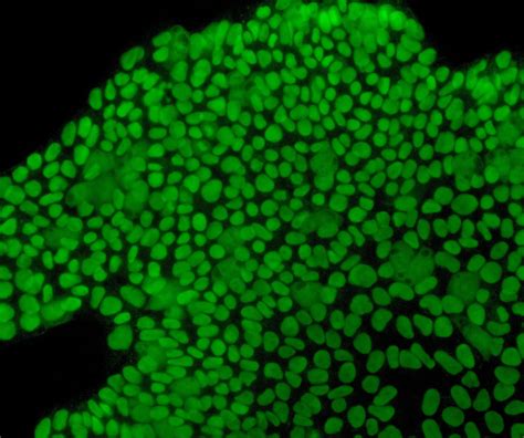 Seed And Go Ipscs Cellected