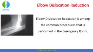 Elbow Dislocation Reduction Step By Step Technique And Splint