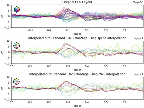 Interpolate Eeg Data To Any Montage — Mne 1100 Documentation