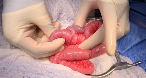Intussusception Reduction Clinicians Brief