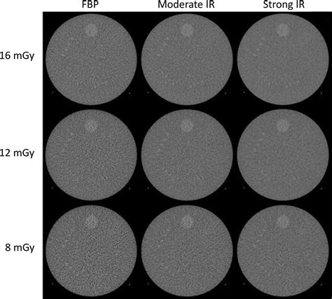 Ct Noise Reduction Methods For Lower Dose Scanning Strengths And Weaknesses Of Iterative