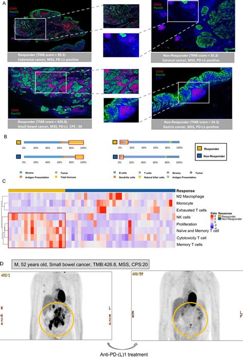Characteristics Of The Tumor Microenvironment In Responders With Tmb H Download Scientific