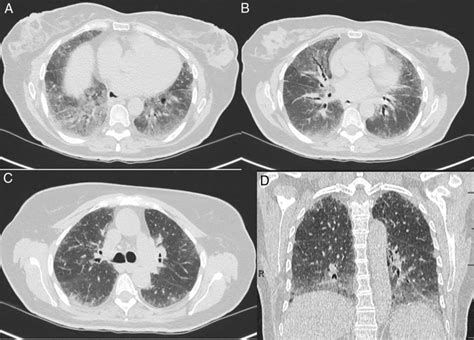 A Sagittal Plane In Chest Computed Tomography Ct Scan With Download Scientific Diagram